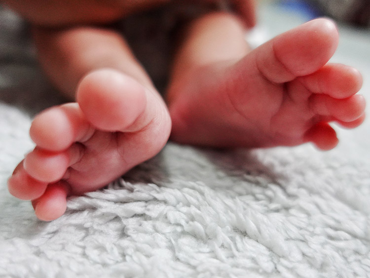 ¿Qué es el Pie Bot? ¿En qué consiste el Método Ponseti? - Hospital ...